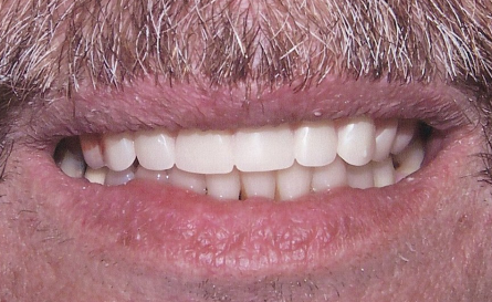 Smile Gallery - Pleasant Ridge Family Dentistry - Woodward Dentist
